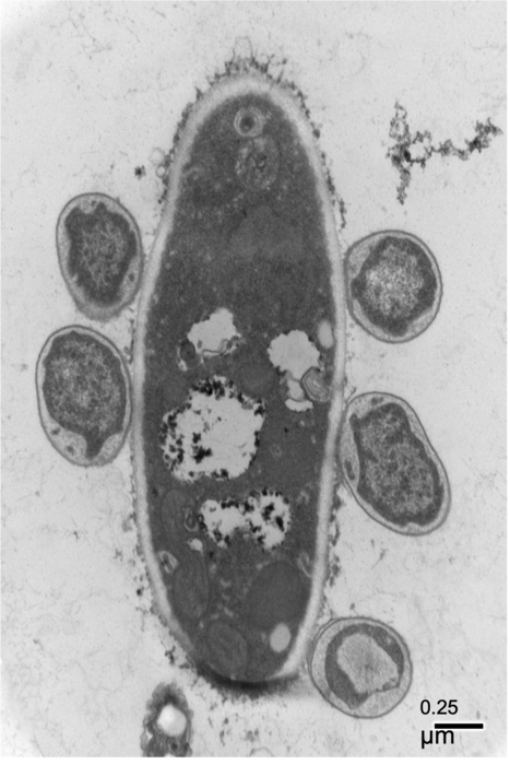 Cyanoraptor cells attack ambus [IMAGE] | EurekAlert! Science News Releases