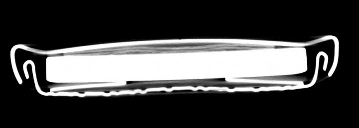 Coin Cell Battery Cross Sectio [IMAGE] | EurekAlert! Science News Releases