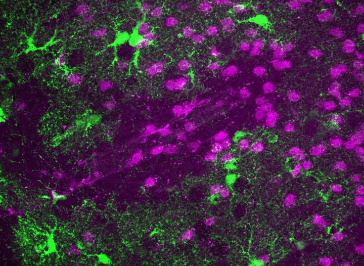 Leaky Blood-Brain Barrier [IMAGE] | EurekAlert! Science News Releases