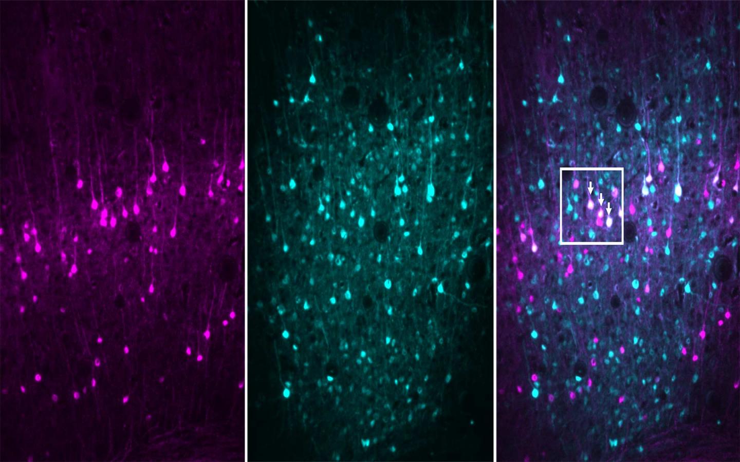 Mouse Auditory Cortex [IMAGE] | EurekAlert! Science News Releases