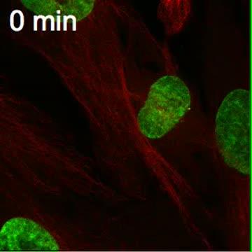 Cellular sentinel prevents cell division when | EurekAlert!