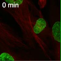 Cellular sentinel prevents cell division when | EurekAlert!