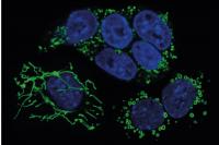 Revealing the secrets of cell competition | EurekAlert!