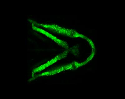 Developing Zebrafish Skeleton [IMAGE] | EurekAlert! Science News Releases