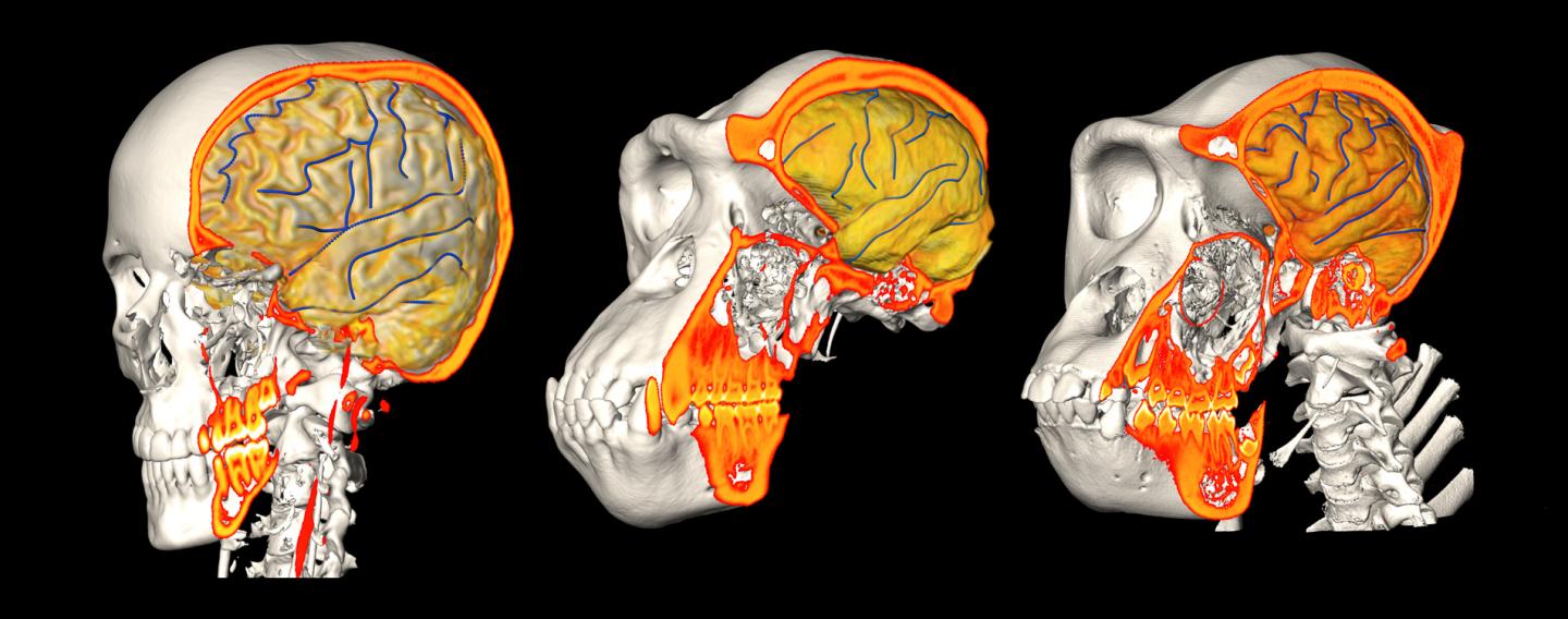 CT/MRI Skull and Brain Imaging [IMAGE] | EurekAlert! Science News Releases