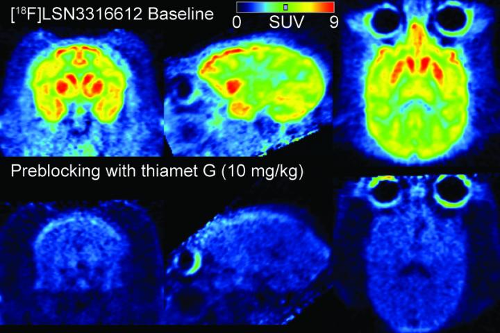 Safer Radioligand Agents Empower PET Imaging | EurekAlert!