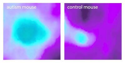 Insular cortex alterations in mouse models of | EurekAlert!
