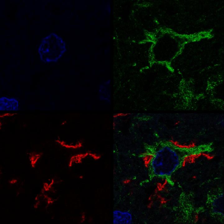 MANF: A Potential Therapeutic Strategy for St | EurekAlert!