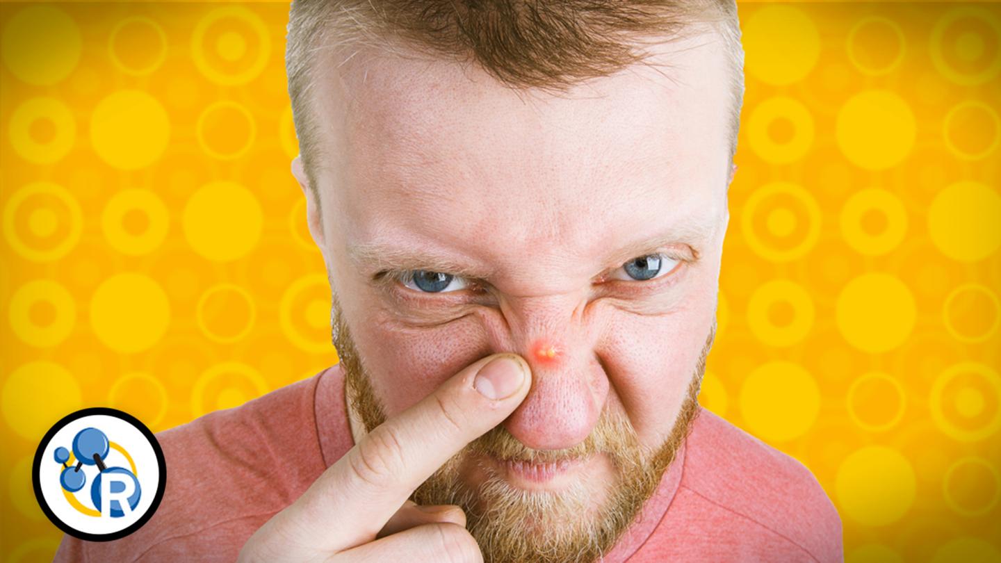 How to stop acne with science (video) | EurekAlert!