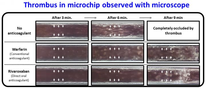 Thrombus Formation as Viewed i [IMAGE] | EurekAlert! Science News Releases