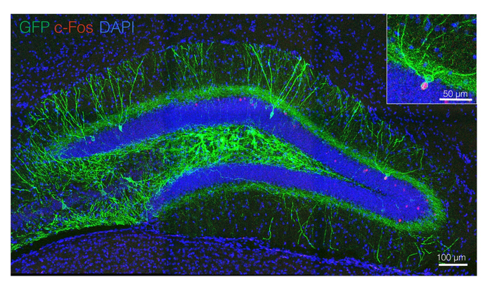 An engram cell. [IMAGE] | EurekAlert! Science News Releases
