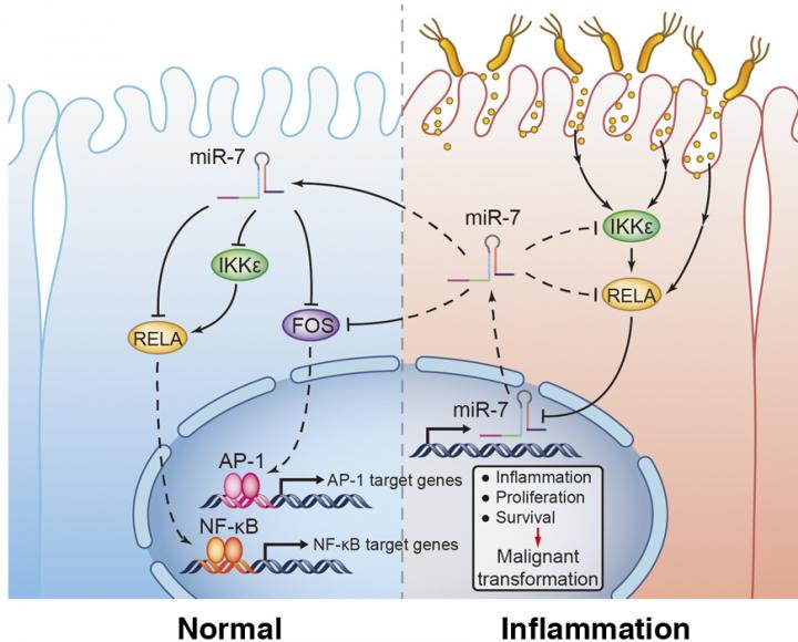 miR-7 Suppresses Stomach Cance [IMAGE] | EurekAlert! Science News Releases