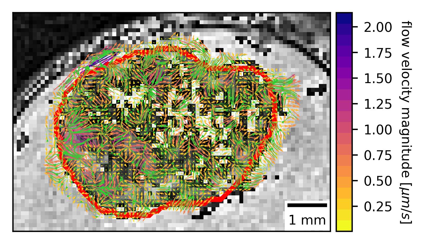 A first look at interstitial fluid flow in th | EurekAlert!