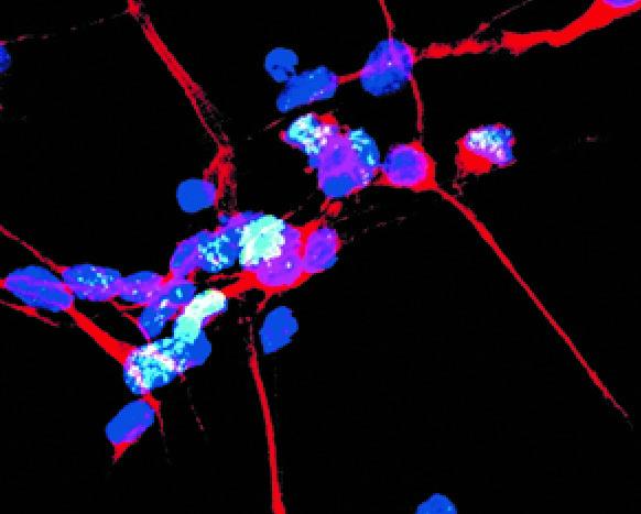 Dopamine Neurons [IMAGE] | EurekAlert! Science News Releases