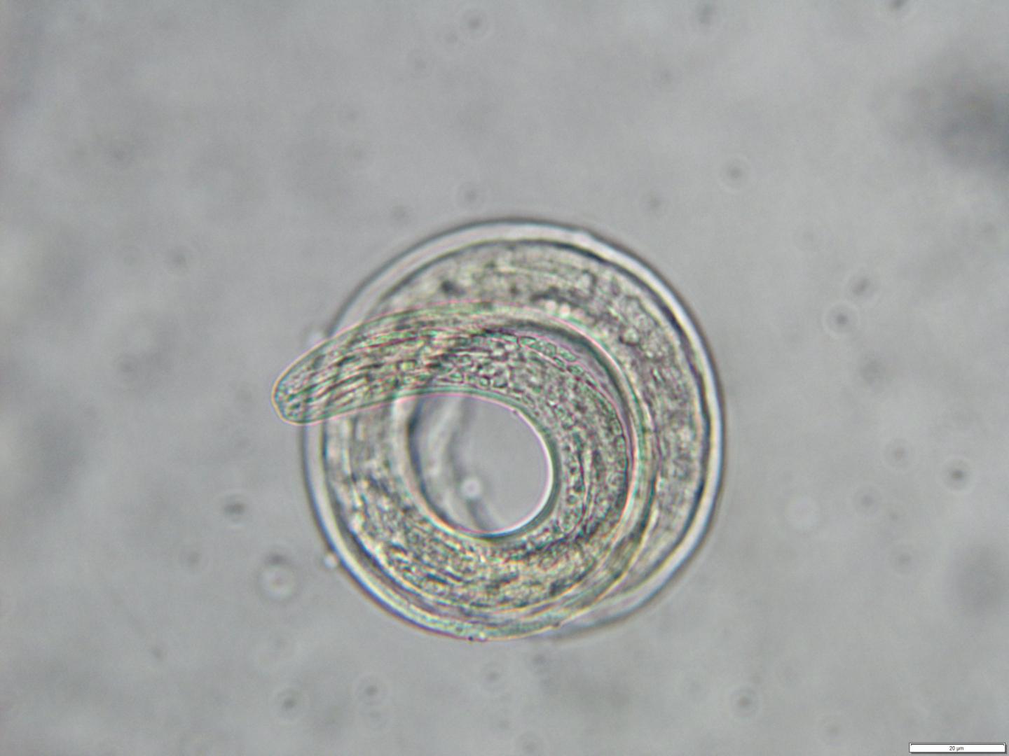 Rat Lungworm Found Throughout [IMAGE] | EurekAlert! Science News Releases