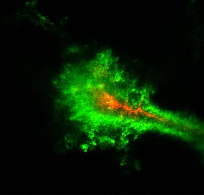 Brain-Penetrating Nanoparticles (1 of 3) | EurekAlert!