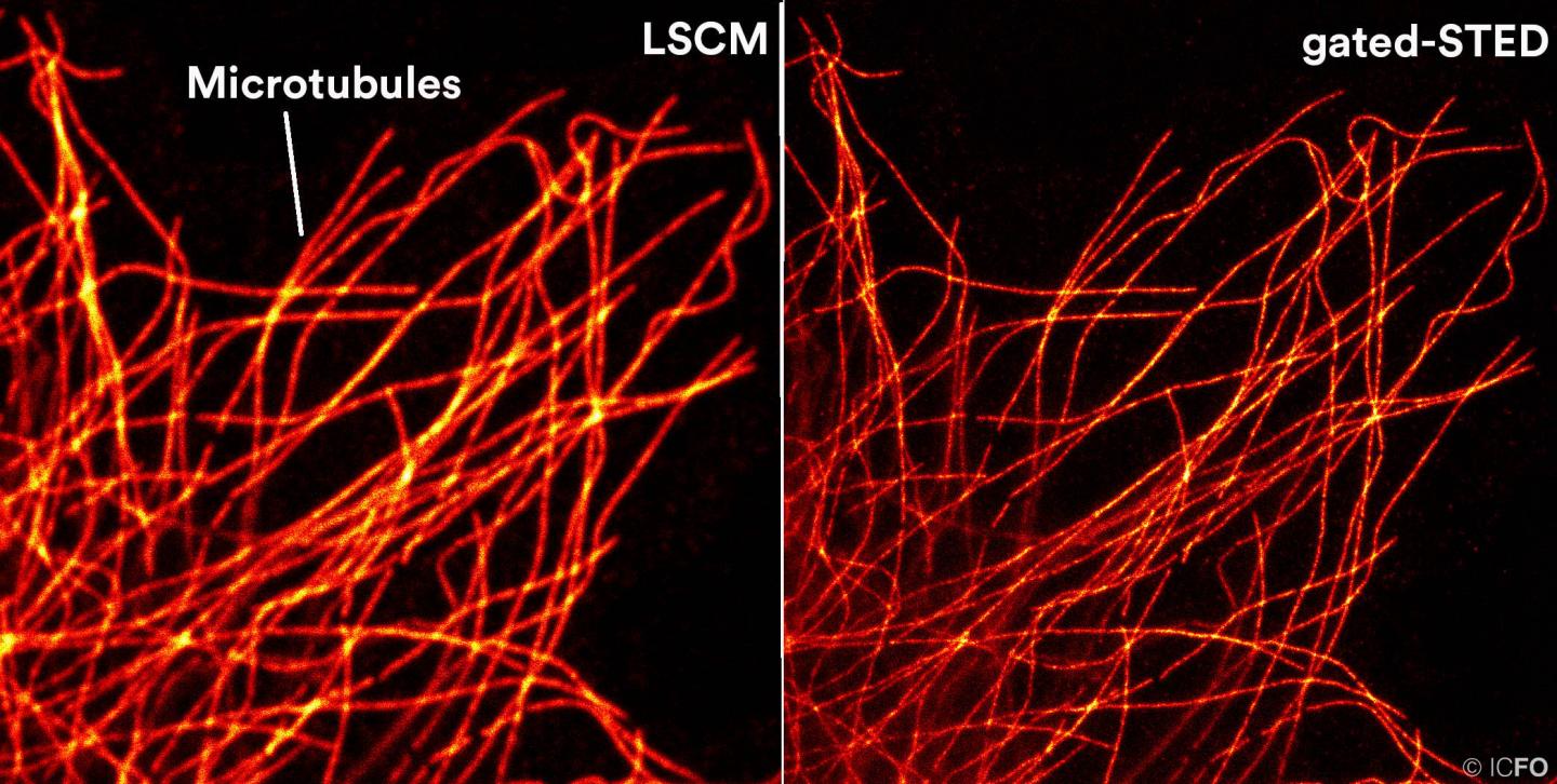 Microtubules Imaging Acquired [IMAGE] | EurekAlert! Science News Releases