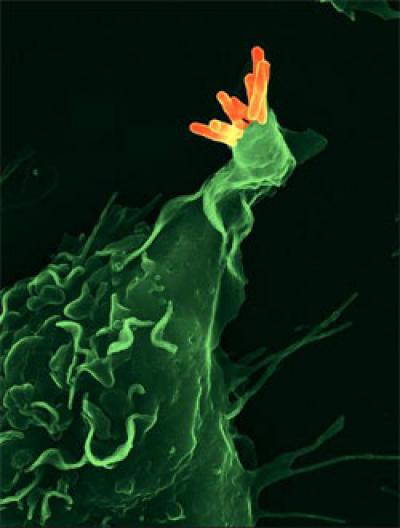 Tuberculosis Bacteria [IMAGE] | EurekAlert! Science News Releases