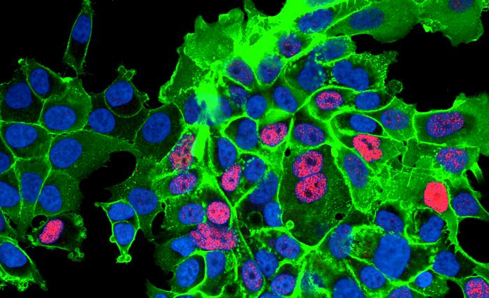 Prostate cancer cells and stem [IMAGE] | EurekAlert! Science News Releases