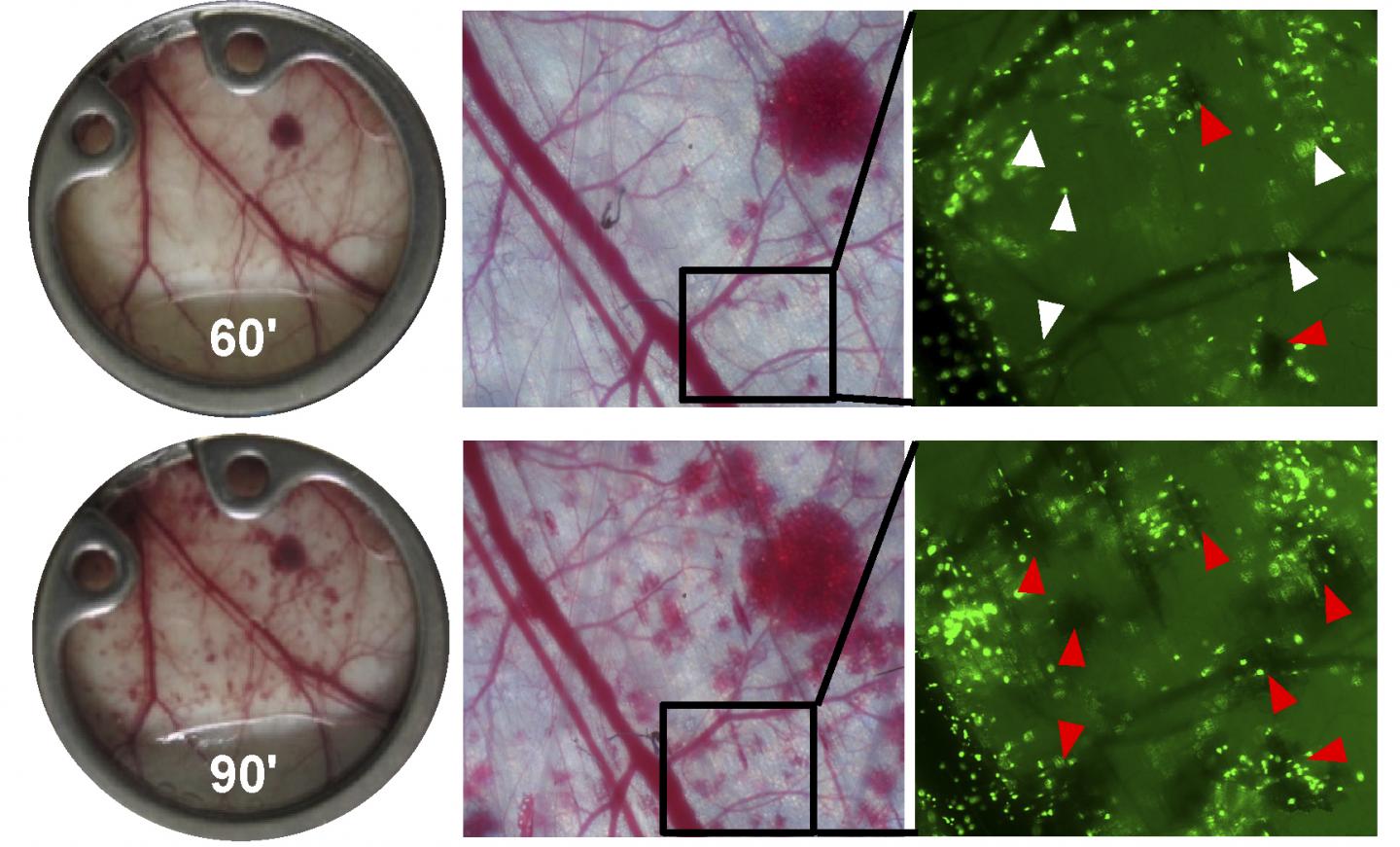 Neutrophils Induce Bleeding [IMAGE] | EurekAlert! Science News Releases