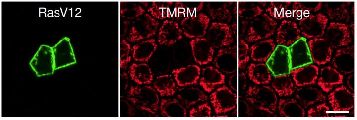 Transformed Cells [IMAGE] | EurekAlert! Science News Releases