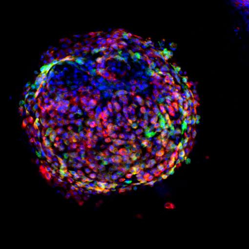 Mature Club Cells [IMAGE] | EurekAlert! Science News Releases