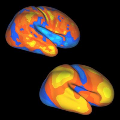 Brain Expansion Compared [IMAGE] | EurekAlert! Science News Releases