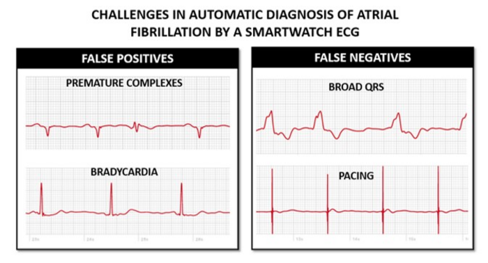 Are Smartwatch Health Apps To Detect Atrial F EurekAlert 