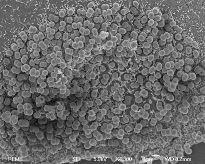 On the Makings of Meningitis | EurekAlert!