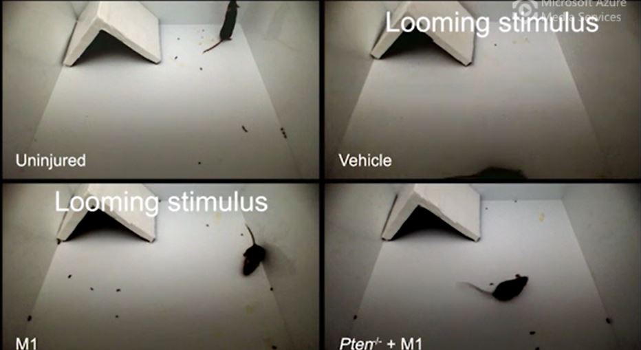CityU neuroscientists identify a small molecu | EurekAlert!