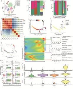 Exploring the R-ISS stage-specific regular ne | EurekAlert!