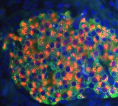 Insulin-Secreting Beta Cells 2 [IMAGE] | EurekAlert! Science News Releases