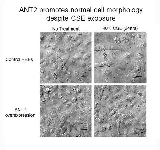 Overexposing ANT2 Gene Counter [IMAGE] | EurekAlert! Science News Releases