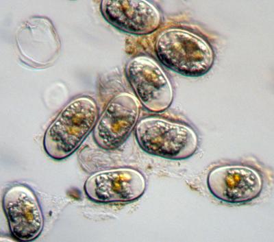 Harmful Algae -- Alexandriu [IMAGE] | EurekAlert! Science News Releases