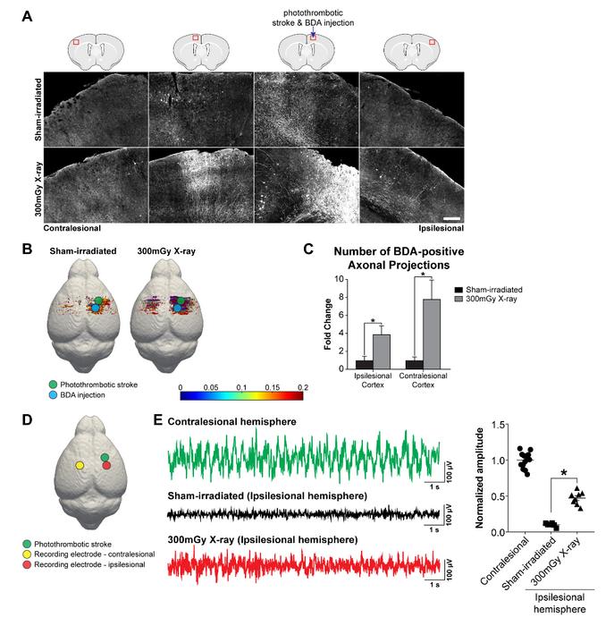 LDIR treatment induces axonal [IMAGE] | EurekAlert! Science News Releases