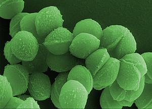 Streptococcus pyogenes [IMAGE] | EurekAlert! Science News Releases