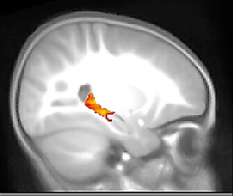 Using fMRI to Measure Memory i [IMAGE] | EurekAlert! Science News Releases