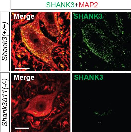 New Research Shows How Autism-Linked Mutation | EurekAlert!