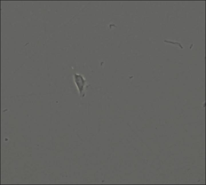 Human Skeletal Stem Cell [IMAGE] | EurekAlert! Science News Releases