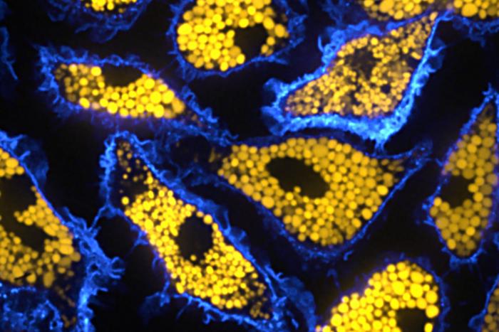 Cellular inflammation uncovere [IMAGE] | EurekAlert! Science News Releases