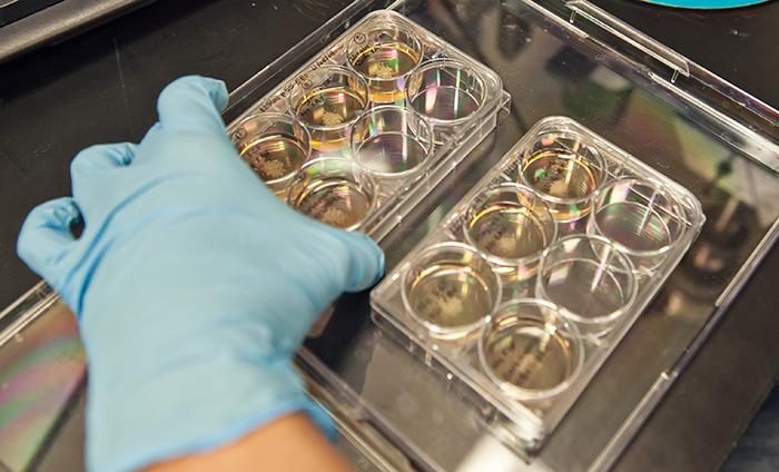 Bipolar Disorder Stem Cells [IMAGE] | EurekAlert! Science News Releases