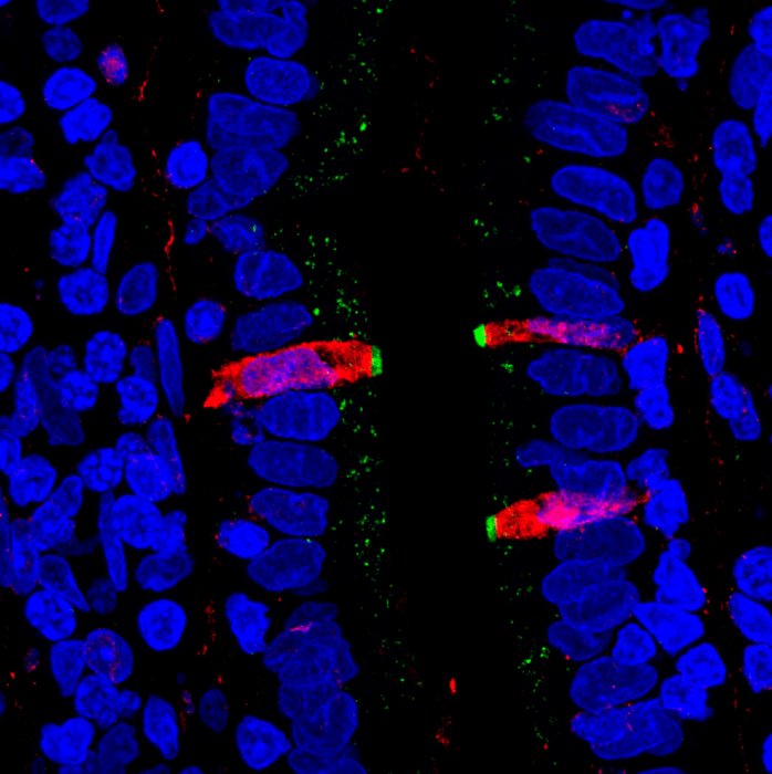 CFTR [IMAGE] | EurekAlert! Science News Releases