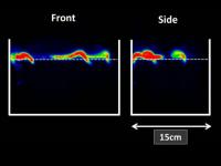 Seeing the unseen: PET/CT scans reveal worms' | EurekAlert!