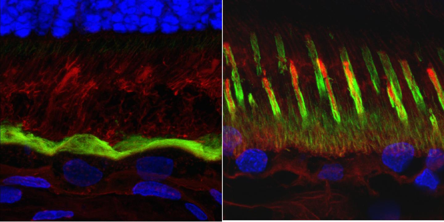 Best Disease in the Retina [IMAGE] | EurekAlert! Science News Releases