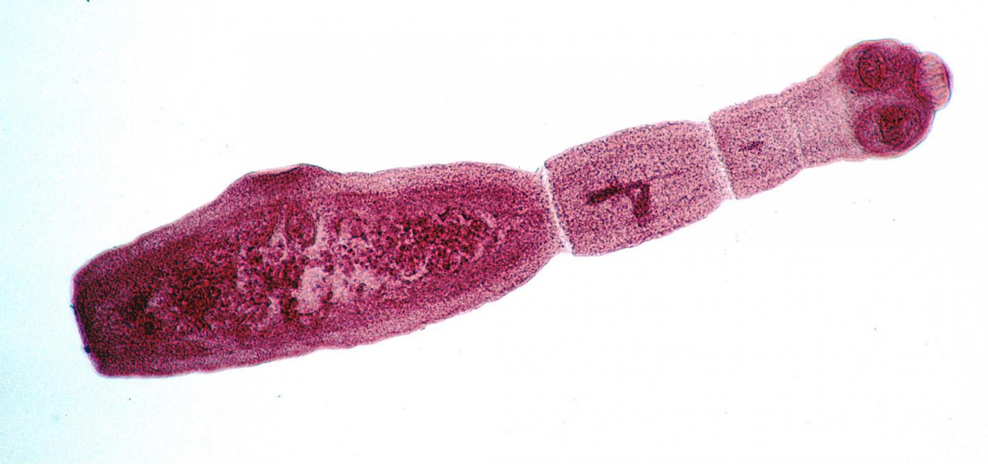 Echinococcus Multilocularis [image] Eurekalert Science News Releases