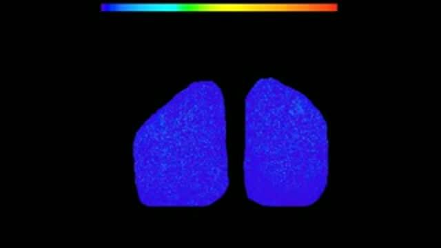 Scary Smells Make More of An Impression (2 of | EurekAlert!