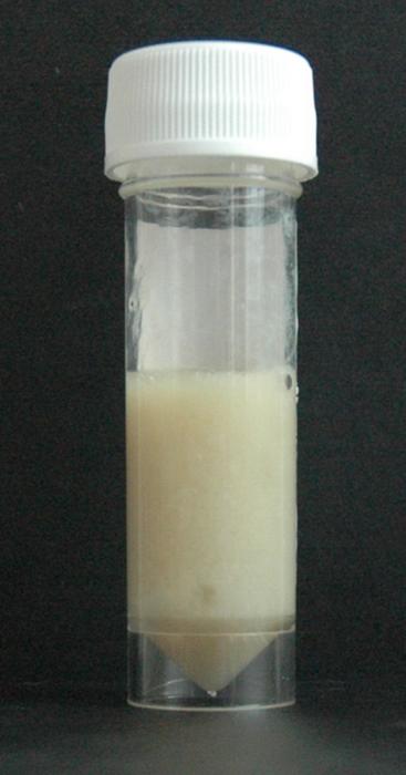 Colour of phlegm can predict o [IMAGE] | EurekAlert! Science News Releases