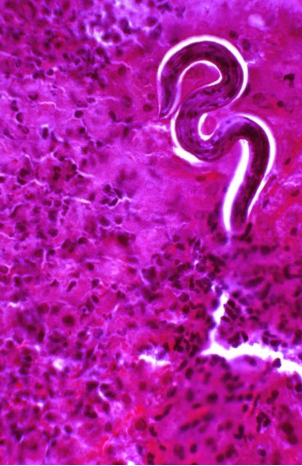 Susceptibility and resistance to the Ascaris | EurekAlert!