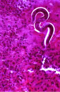 Susceptibility and resistance to the Ascaris | EurekAlert!