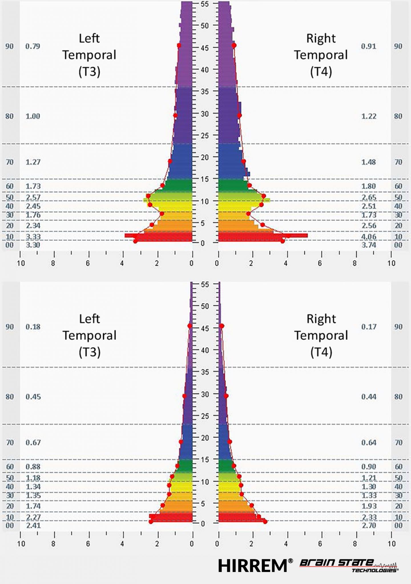 Brain State Technologies: Successful clinical | EurekAlert!